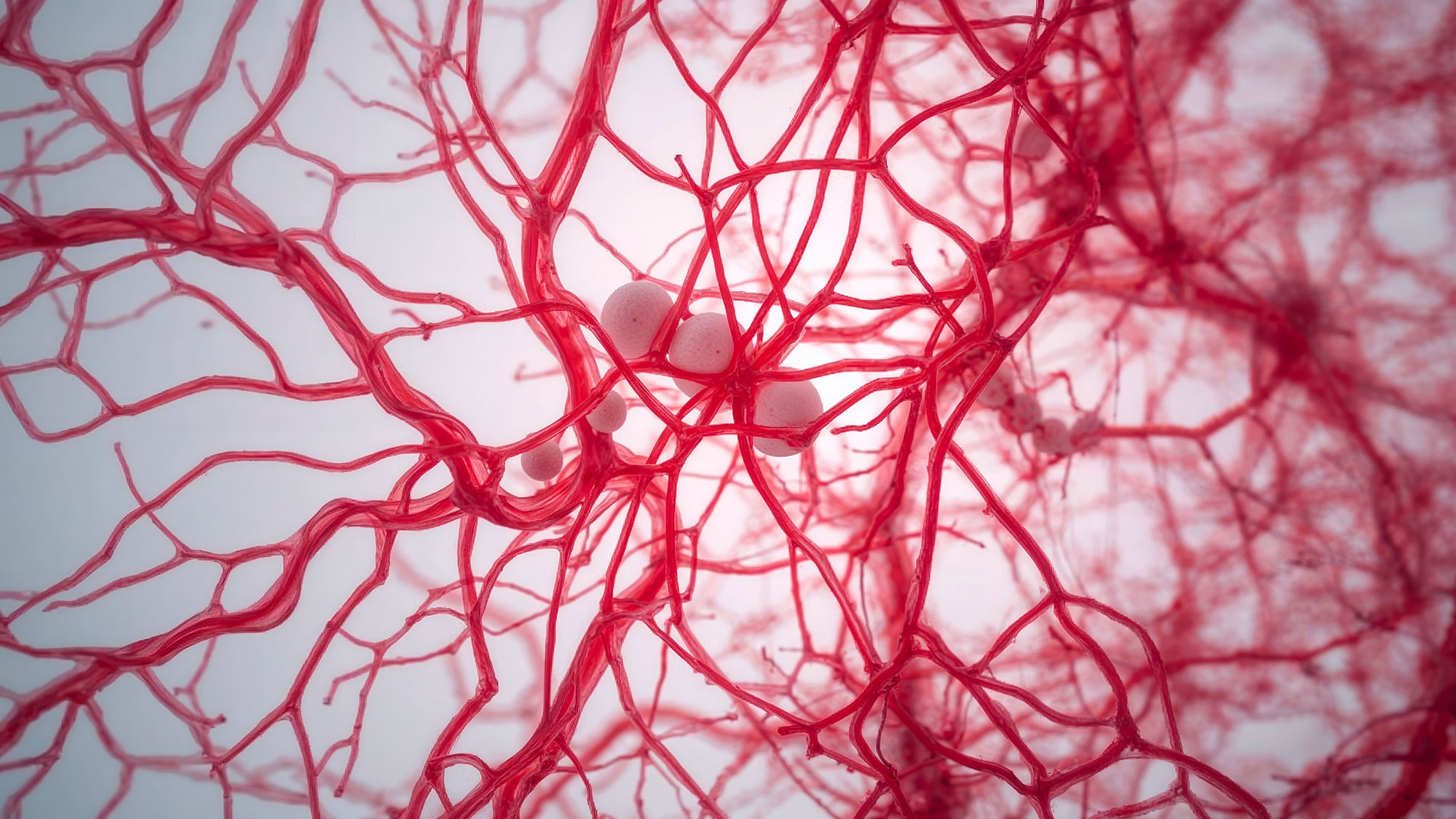 Aps vascolare: challenges diagnostiche e terapeutiche | Il Bo Live Unipd